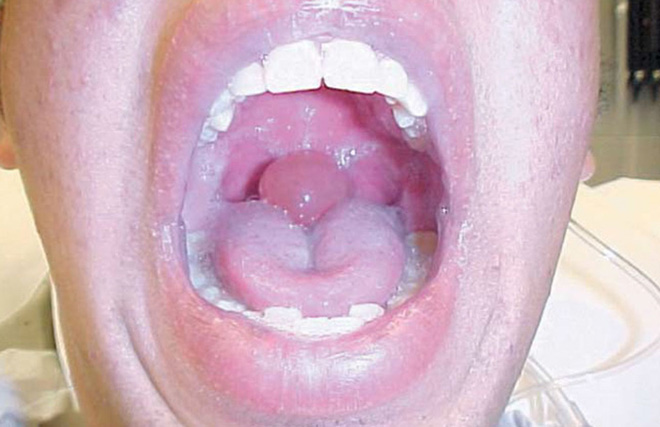 Allergy/Immunology | AMBOSS Rotation Prep